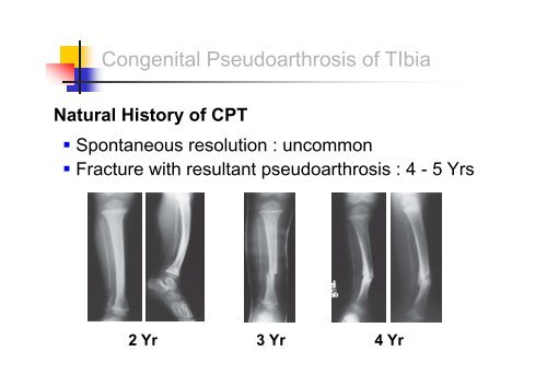 Congenital
