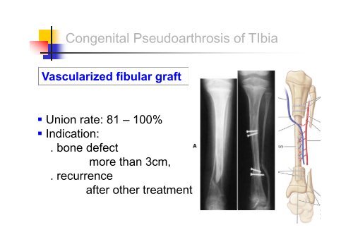 Congenital
