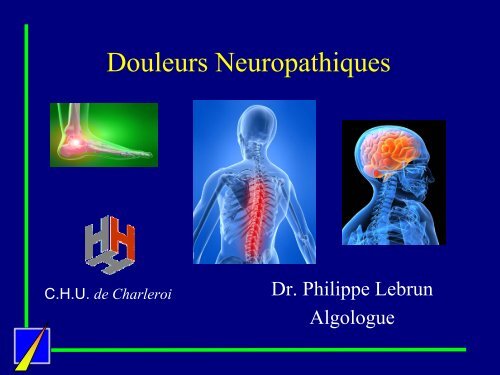 Douleurs Neuropathiques - Chi2