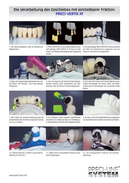 PRECI-VERTIX HOUSING FR - Ceka - Preciline Home