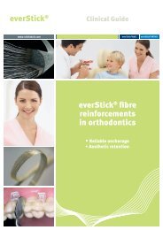 everStick®C&B fibre reinforced bridge for anterior region ... - StickTech