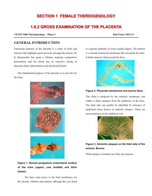 Zonary Placenta Anatomy 1911 Encyclopædia Britannica/Placenta