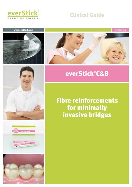 everStick®C&B Fibre reinforcements for minimally ... - StickTech