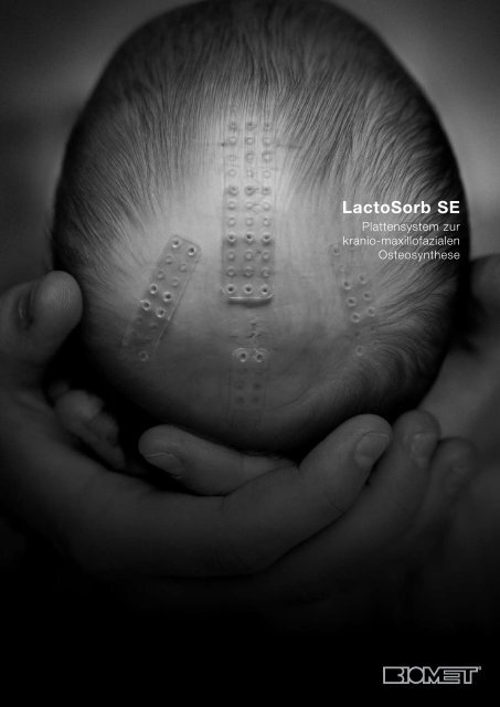 LactoSorb SE - Biomet