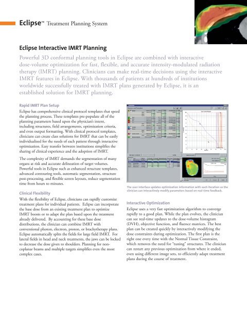 Eclipse Interactive IMRT Planning - Behestan Darman