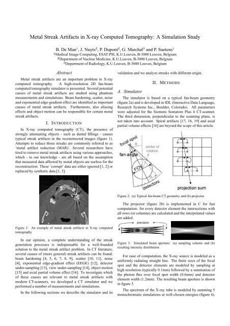Metal Streak Artifacts in X-ray Computed Tomography: A Simulation ...