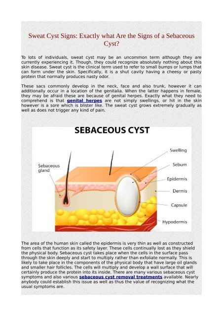Sweat Cyst Signs: Exactly what Are the Signs of a Sebaceous Cyst?.pdf
