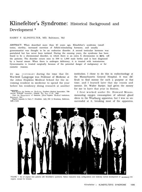 s - XXY Information Klinefelter Syndrome