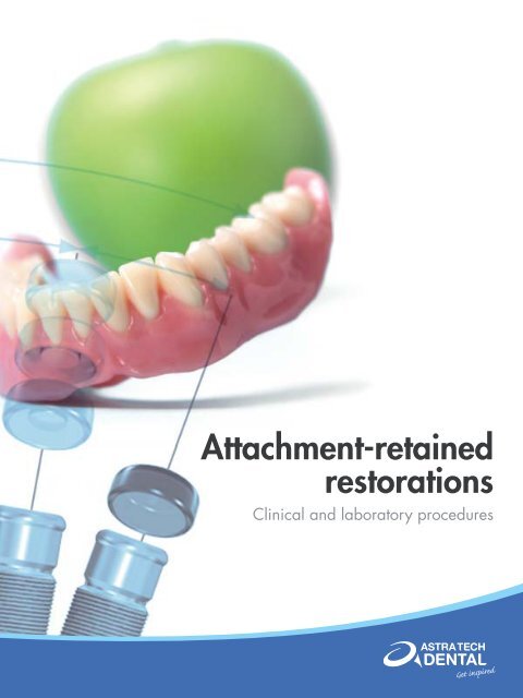 Attachment-retained restorations