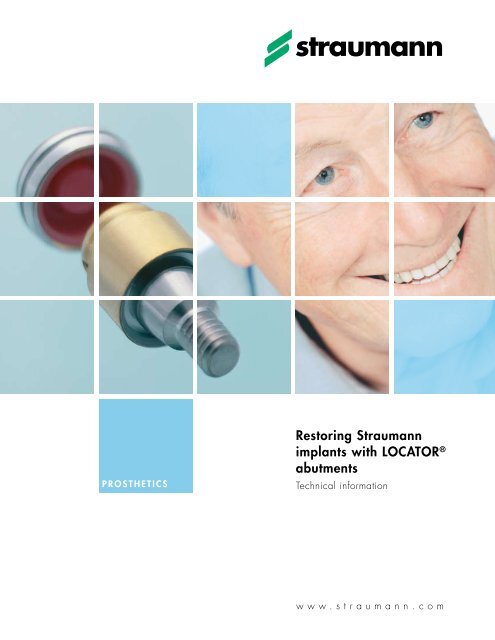 Restoring Straumann implants with LOCATOR abutments