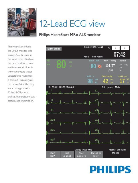 Line Ecg View Technology Ambulance 12 Lead Electrocardiography