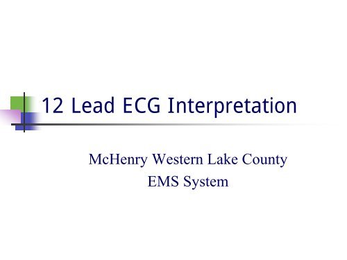 12 Lead ECG Interpretation