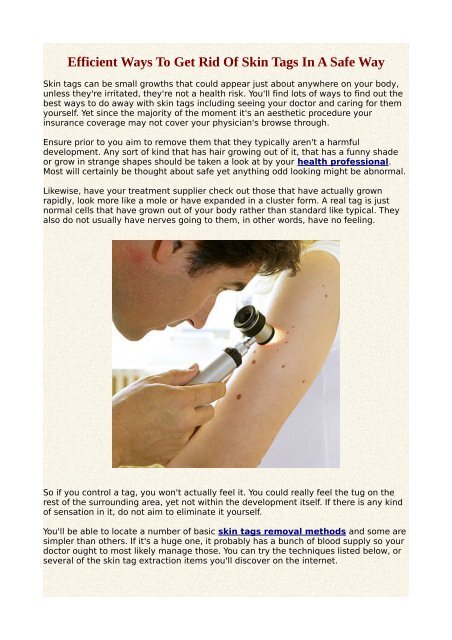 Efficient Ways To Get Rid Of Skin Tags In A Safe Way.pdf