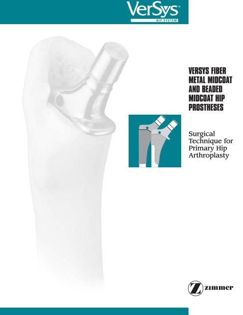 VERSYS FIBER METAL MIDCOAT AND BEADED MIDCOAT HIP PROSTHESES