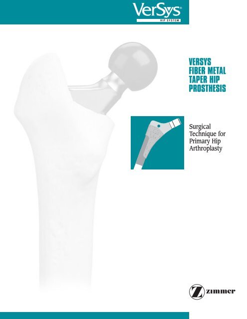 VERSYS FIBER METAL TAPER HIP PROSTHESIS