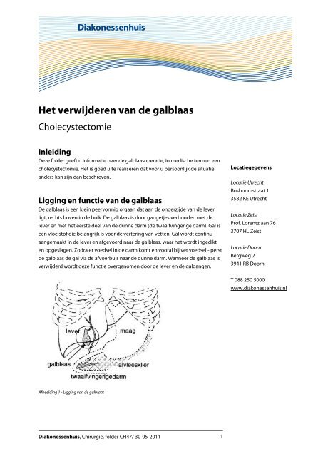 Het verwijderen van de galblaas