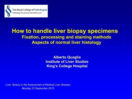 How to handle liver biopsy specimens