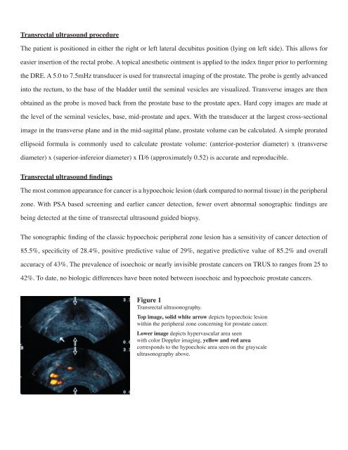 Transrectal ultrasound pr