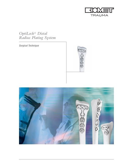 OptiLock® Distal Radius Plating System