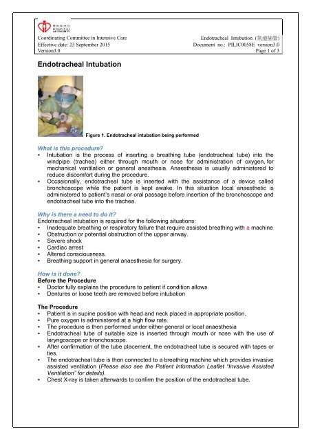 Endotracheal Intubation
