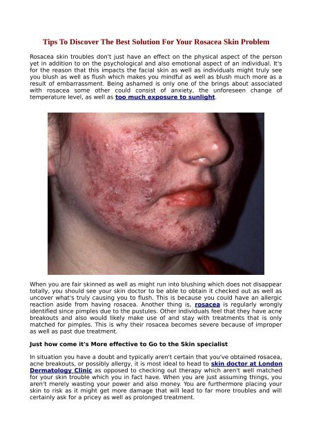 Tips To Discover The Best Solution For Your Rosacea Skin Problem