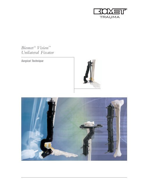 Biomet® Vision™ Unilateral Fixator