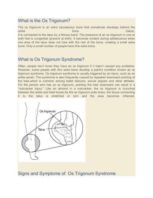 What is the Os Trigonum