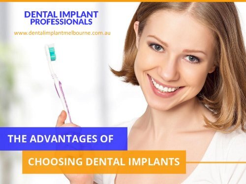 Advantages of Choosing Dental Implants Advantages of Choosing Dental Implants
