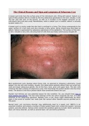 Sweat Cyst Signs: Exactly what Are the Signs of a Sebaceous Cyst?.pdf
