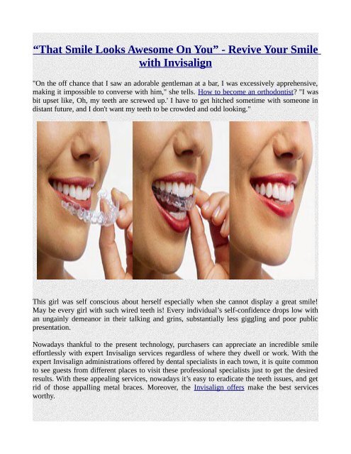 That Smile Looks Awesome On You” - Revive Your Smile with Invisalign