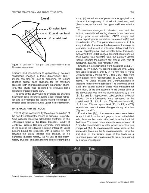 FACTORS RELATED TO ALVEOL