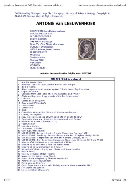 1674 Leeuwenhoeks Simple Microscope