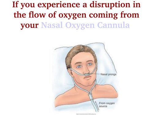 Nasal cannula uses store