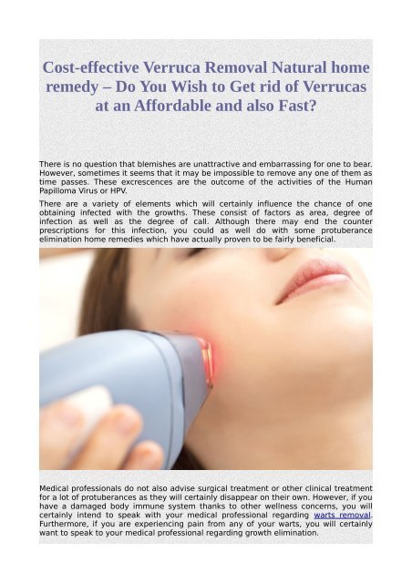 Cost-effective Verruca Removal Natural Home Remedy
