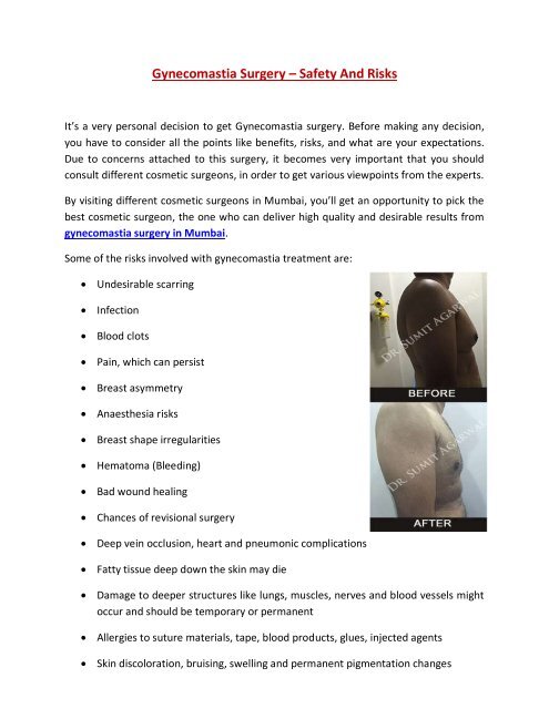 Gynecomastia Surgery Safety and Risks