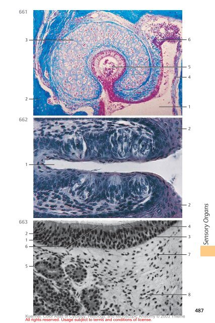 661 Eustachian Tube—Aud
