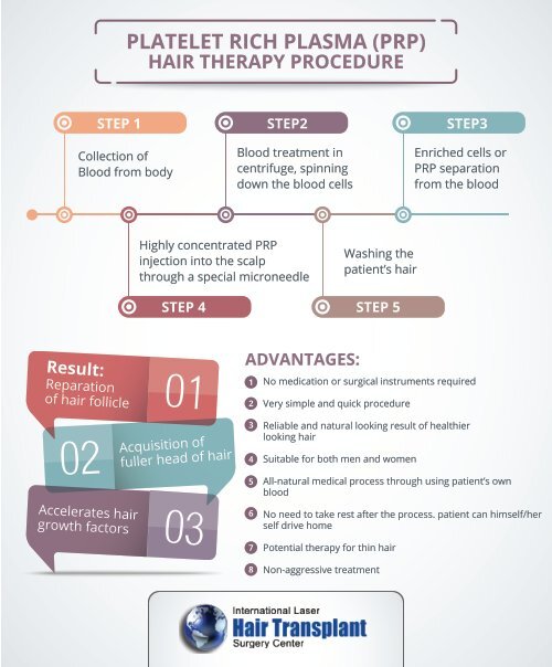 PRP Hair Treatment Pakistan - Infographic