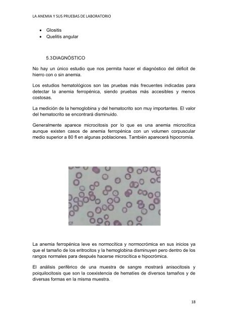 LA ANEMIA Y SUS PRUEBAS D