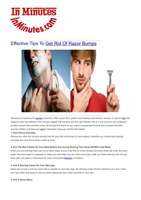 Effective Tips To Get Rid Of Razor Bumps
