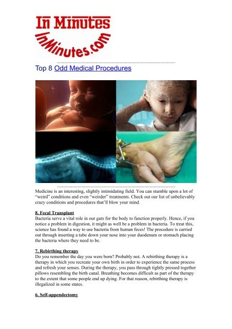 Top 8 Odd Medical Procedures