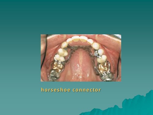 horseshoe connector