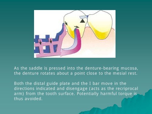 RPI The RPI system is des