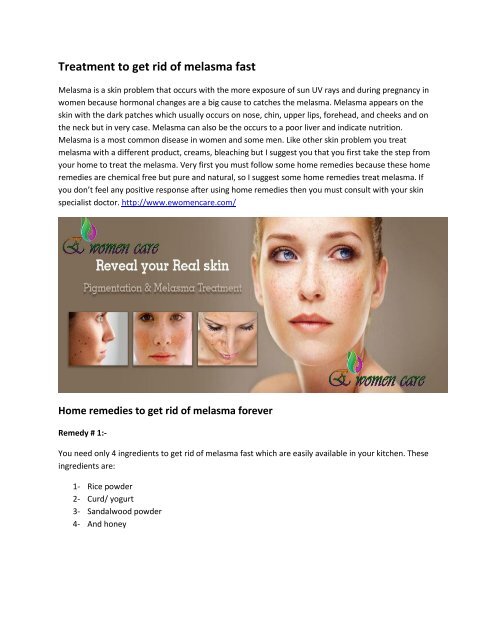 get rid of melasma fast