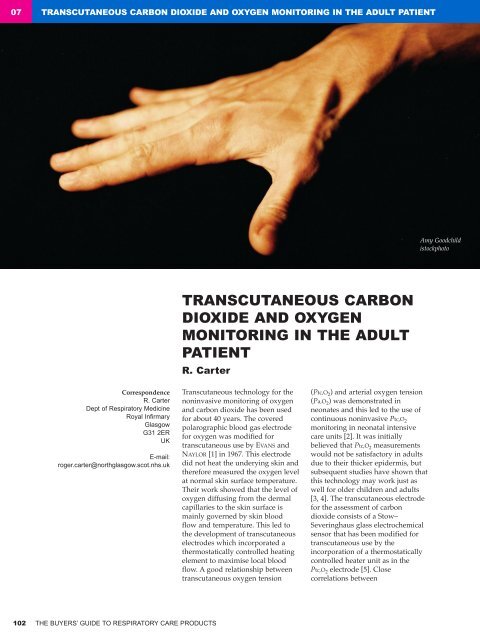 Transcutaneous Carbon Dioxide And Oxygen Monitoring In The Adult