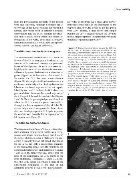 Sonographic