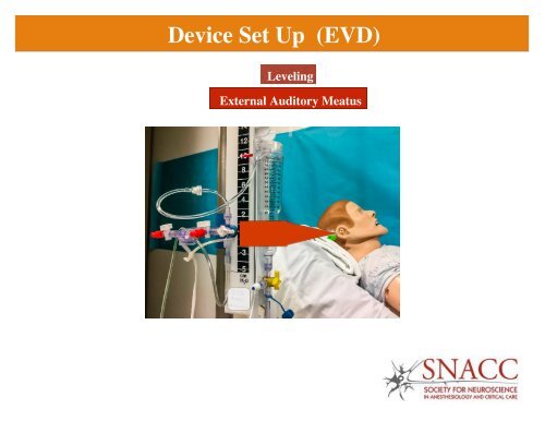 Device Set Up Carpenter