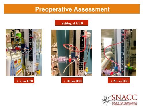 Preoperative Assessment S