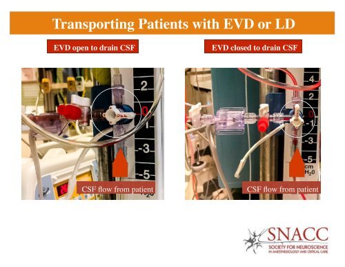 Transporting Patients wit