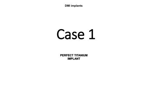 Perfect-Case 1