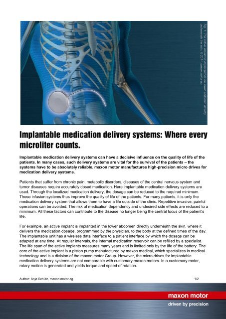 maxon motor - implantable medication delivery systems.